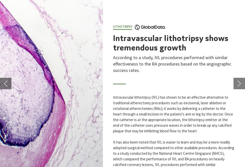 Intravascular lithotripsy shows tremendous growth - Medical Technology ...